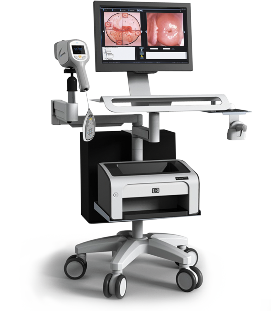 Multi-functional Trolley Colposcope Video Machine NEUCE08 | Neuvar