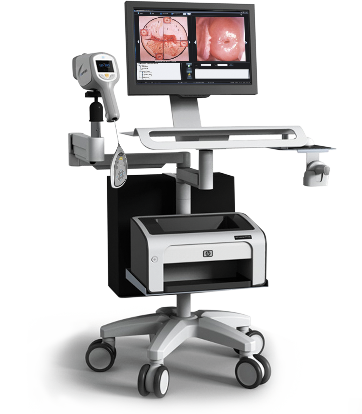 Multi-functional Trolley Colposcope Video Machine NEUCE08 | Neuvar